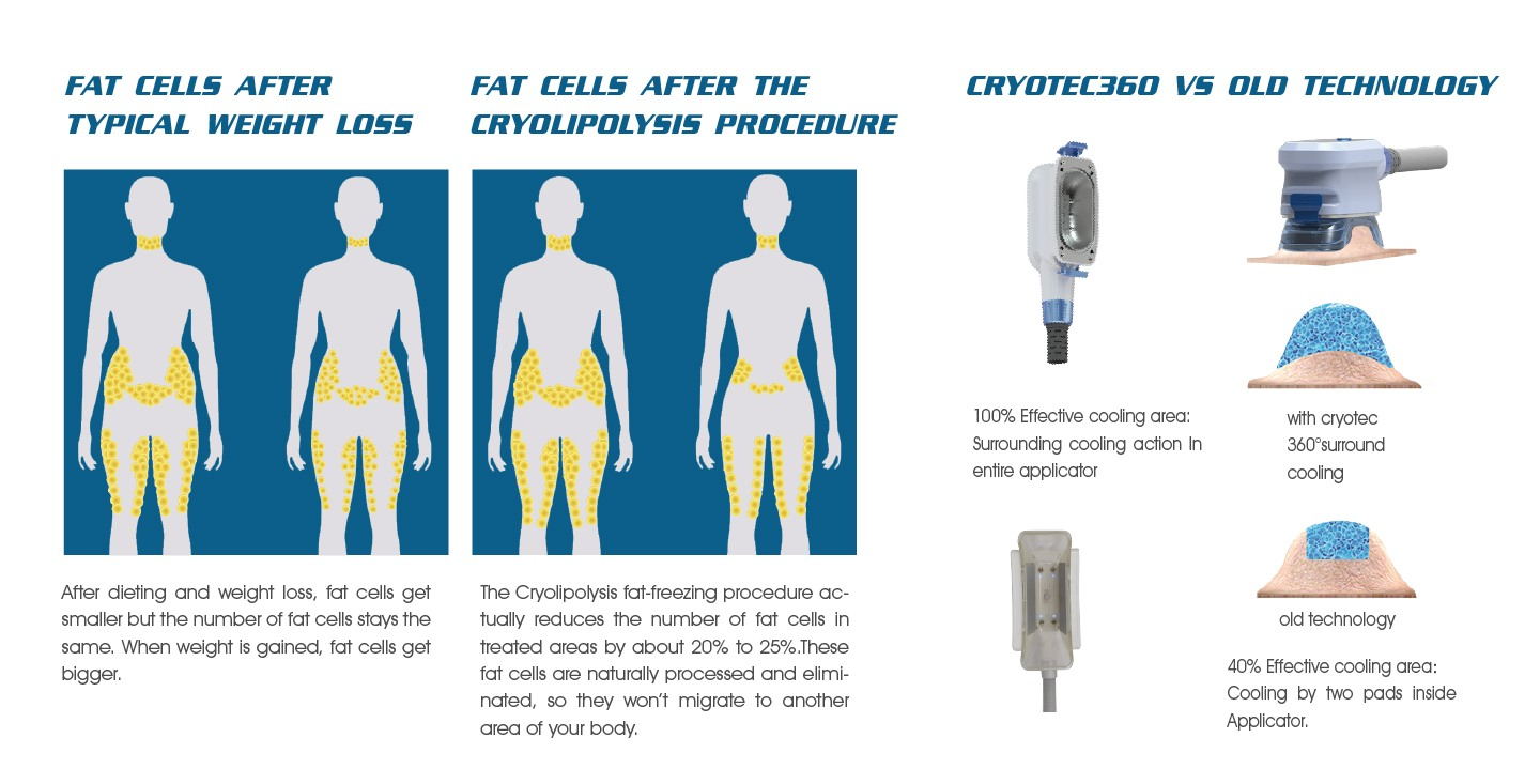 Portable 360 Cryolipolysis Machine|cryolipolysis|cryolipolysis machine ...