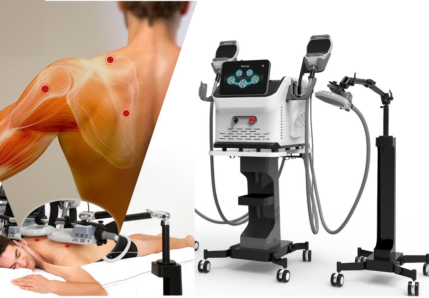 Portable EMS+RF|emsculpt|emsculpting - NUBWAY