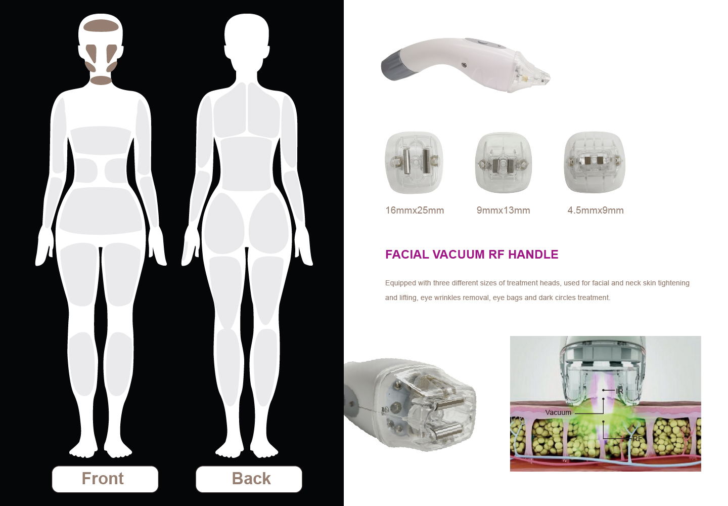 VelaShape Slimming Machine|velashape|velashape machine - NUBWAY