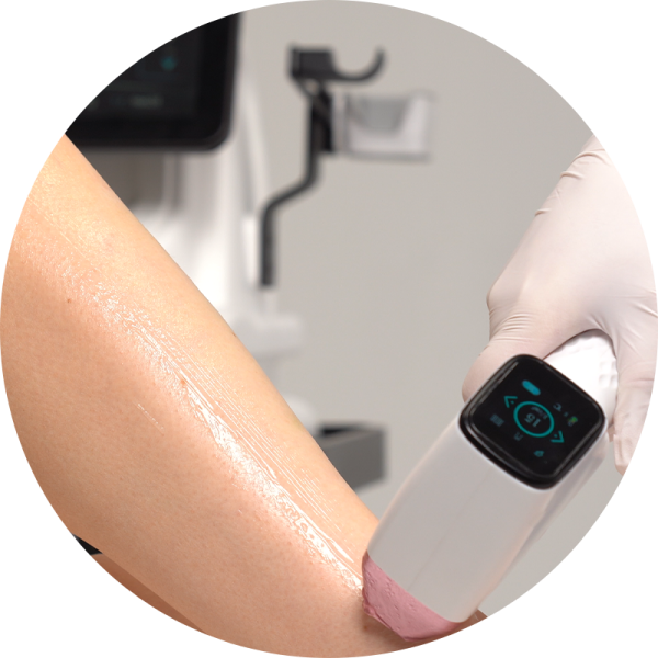 multi spot size diode laser - NUBWAY