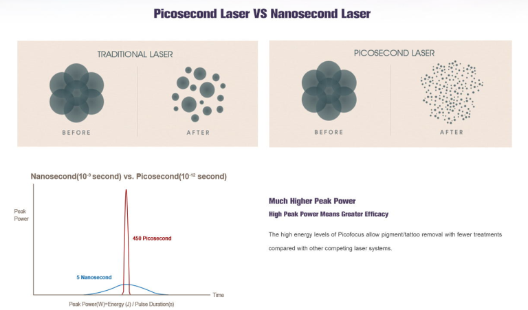 What is a picosecond laser used for? - NUBWAY